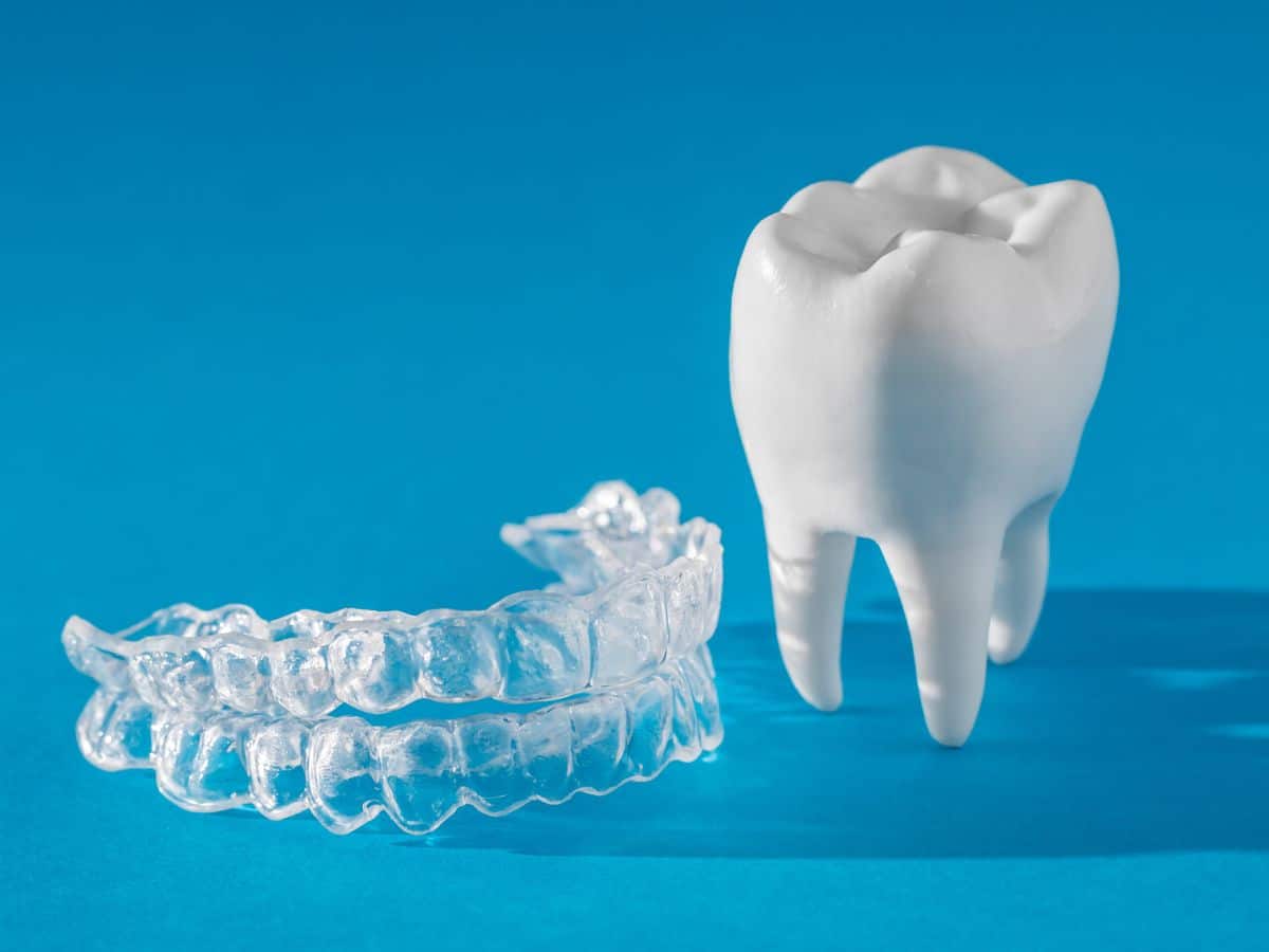 Why Do I Need Attachments for Invisalign? | Holt Orthodontics